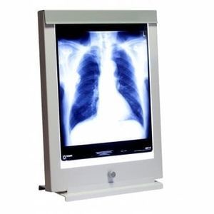 Vertical X-ray film viewer - All medical device manufacturers