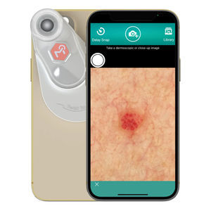 Smartphone-based dermatoscope - All medical device manufacturers
