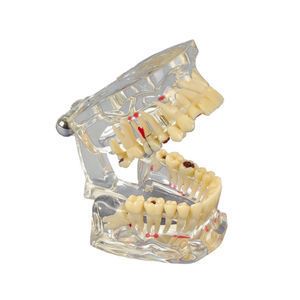 Mandible model - 355643 - Hager & Werken - teeth / dental / maxilla