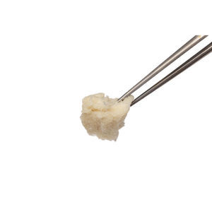 Allograft bone substitute - ViviGen® - Lifenet Health - for orthopedic ...