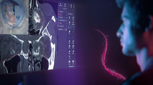 Control software - Brainlab - visualization / planning / interpretation