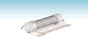 Esophageal stent - HANAROSTENT®(CCC) - M.I Tech