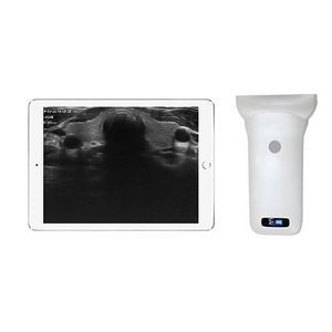 Hand-held ultrasound system - Sonostar Technologies - for multipurpose ...