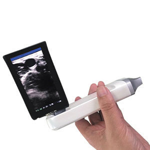 Hand-held ultrasound system - Sonostar Technologies - for ophthalmic ...