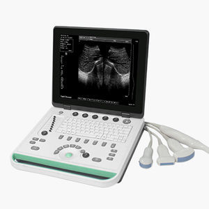 Portable ultrasound system - SS-10 - Sonostar Technologies - for ...