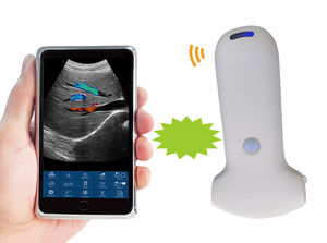 Hand-held ultrasound system - Sonostar Technologies - for multipurpose ...
