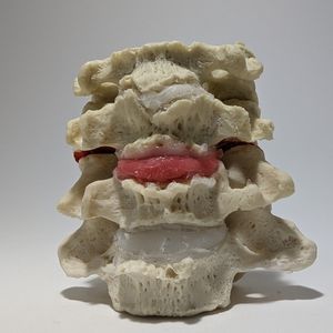 Spine anatomical model - Dynamic Disc Designs Corp. - cervical / for ...