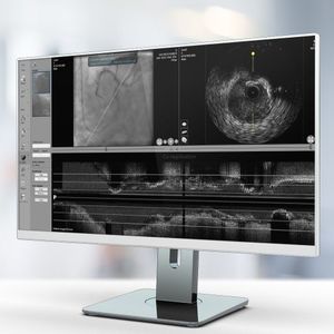 Pie Medical Imaging: Medical Imaging - MedicalExpo