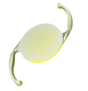 Monofocal intraocular lens - AcrySof® IQ - Alcon