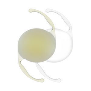 Monofocal intraocular lens - Clareon® Vivity® - Alcon - presbyopia