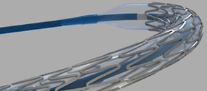 Coronary arteries stent / PLLA / bioresorbable - DESolve™ - Elixir Medical