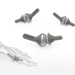 Interphalangeal foot joint implant - Hemi™ - Acumed - first toe joint