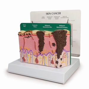 Skin anatomical model - 3900 - GPI Anatomicals - blood vessels / for ...