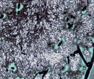 Staining solution reagent - Fouchet Van Gieson - BIO-OPTICA Milano ...