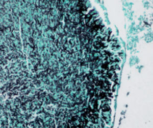 Staining solution reagent - Gram - BIO-OPTICA Milano - for histology ...