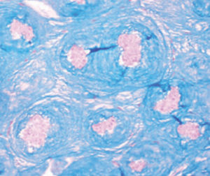 Staining solution reagent - Fouchet Van Gieson - BIO-OPTICA Milano ...