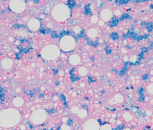 Staining solution reagent - Afog - BIO-OPTICA Milano - for histology ...