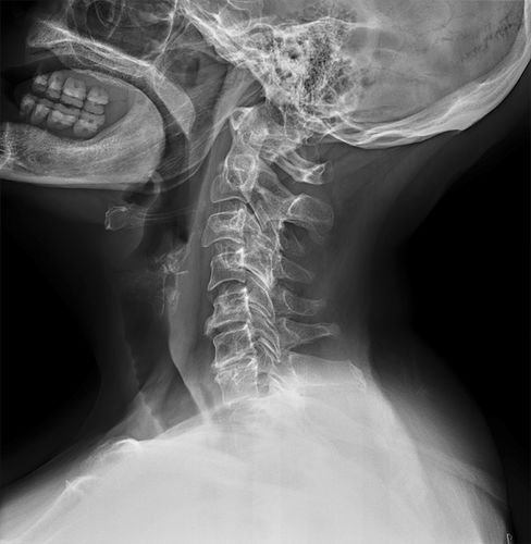 Image enhancement software - Altumira™ - ContextVision - radiography ...