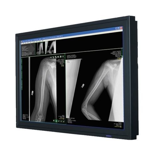Operating room display - FP4204B - Double Black Imaging - endoscopy ...
