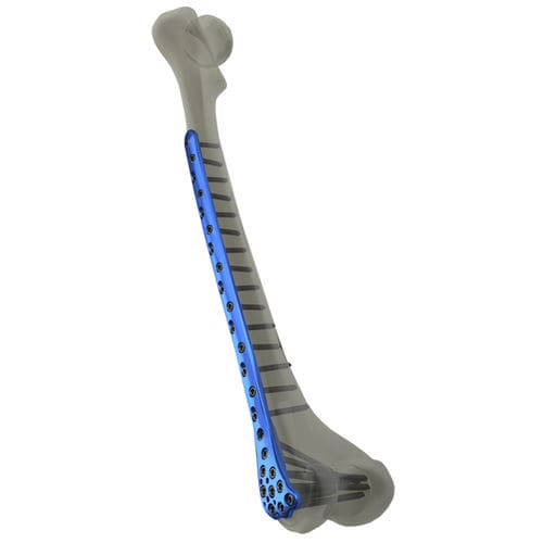 Femur compression plate - Response Ortho - distal / locking / metallic