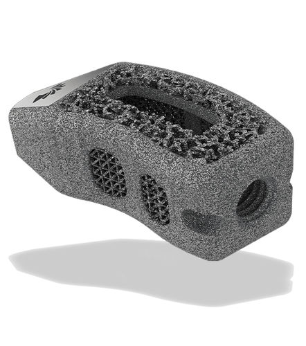 Lumbar interbody fusion cage - TigerShark® Threaded TL - ChoiceSpine ...