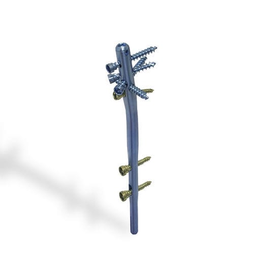 Humeral intramedullary nail - DINAMIC T - Citieffe - proximal fixation