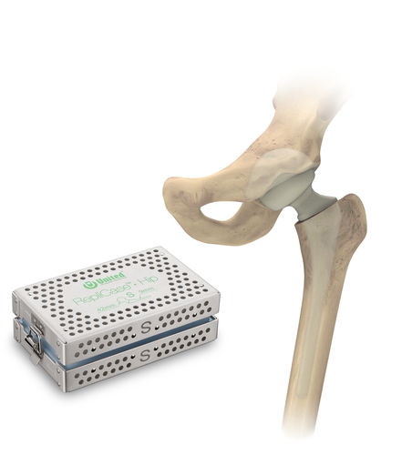 Temporary hip spacer - RepliCase™ - US Orthopedics