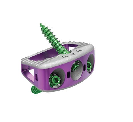 Lumbar interbody fusion cage - ALIF - NuVasive - anterior