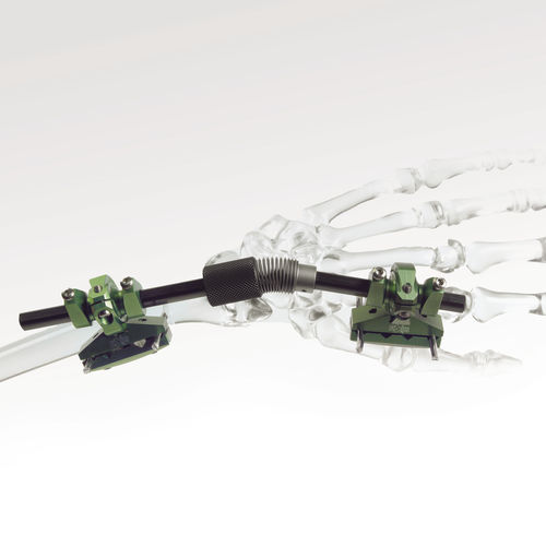 Radius external fixation system - FIXUS33 - Fixus - wrist / humerus ...