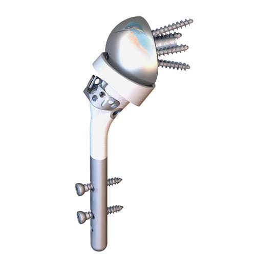 Reverse humeral stem - HUMELOCK II® - FX Solutions - cementless