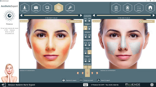Image analysis software module - Pixience - dermatology / aesthetic ...