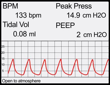 Anesthesia ventilator - RoVent® - Kent Scientific - for animal research / electronic / for mice