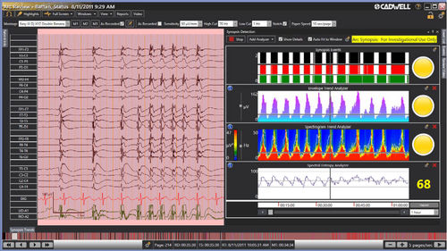 EEG software - ARC SYNOPSIS - Cadwell Industries - analysis / control ...
