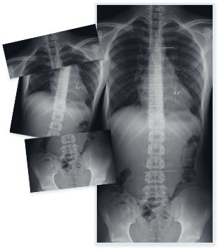 Radiography software - Stitching - Medecom - for doctor's office ...