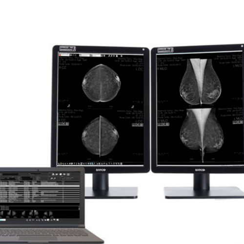 Mammography software - Med Mammo - Medecom - for doctor's office / CT ...