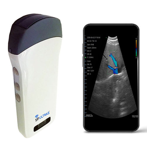 Hand-held ultrasound system - SIFULTRAS-3.3 - SIFSOF - for cardiovascular ultrasound imaging / B ...