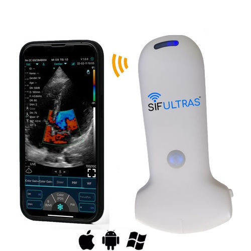Hand-held ultrasound system - SIFULTRAS-5.48 - SIFSOF - for multipurpose ultrasound imaging / B ...