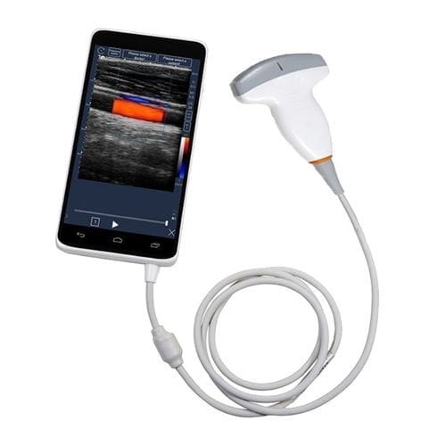 Hand-held ultrasound system - SIFULTRAS-2.21 - SIFSOF - for ...