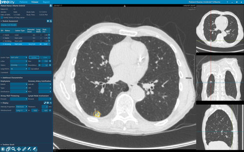 Analysis software - VAREX Imaging - visualization / education / medical