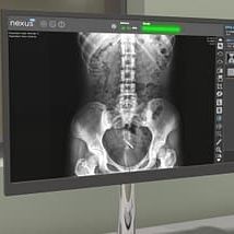 Image analysis software - Nexus DR - VAREX Imaging - acquisition / medical / radiography