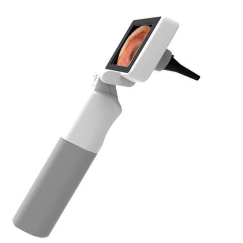 Video otoscope with integrated video monitor - vOtsco - InfraEyes