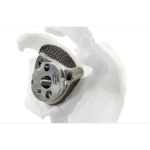 Reverse glenoid cavity prosthesis - Glenius - Materialise UK - revision ...