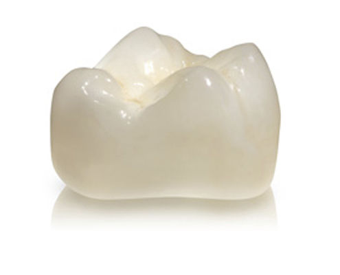 Zirconia dental crown - DIAMOND - Derby Dental - posterior teeth ...