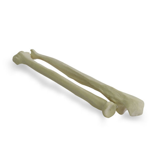 Bone model - 1014D - Nacional Ossos - radius / cubitus / orthopedic surgery