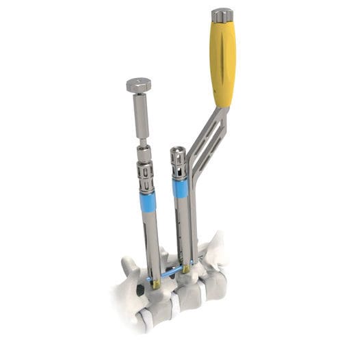 Minimally invasive pedicle screw positioning system - Levissi - NORMMED ...