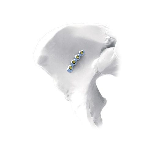 Pelvis compression plate - Curved - NORMMED Medical Devices - locking ...