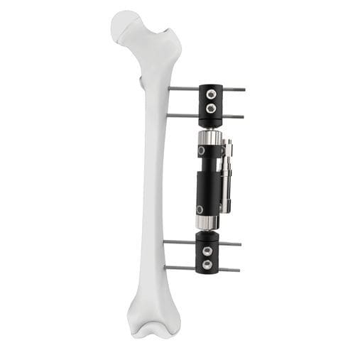 Femur external fixation system - DAF - Peditst - tubular / pediatric