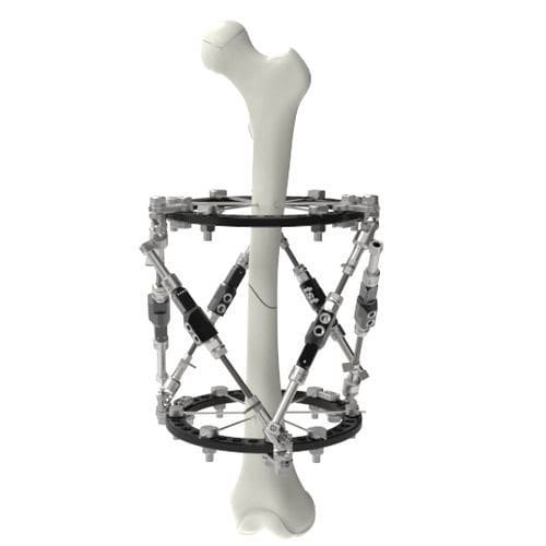 Femur external fixation system - Ortho-SUV® - Peditst - circular ...