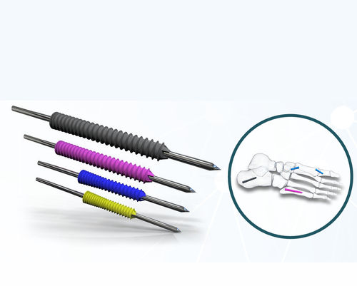 Hallux valgus compression bone screw - EXN02 series - Aleda Medical ...