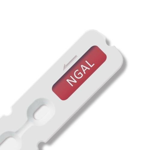 NGAL test kit - 00020C - Beijing O&D Biotech Co., Ltd. - serum / plasma ...
